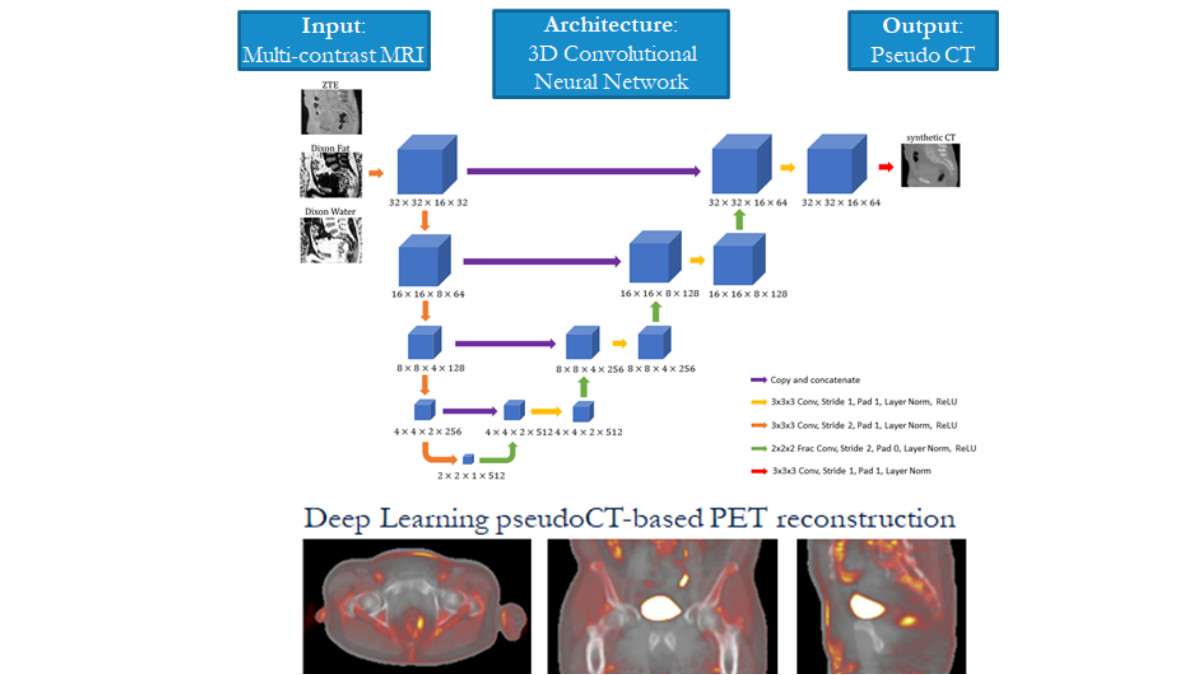 Improving Simultaneous PET/MR through Machine Learning | intelligent imaging